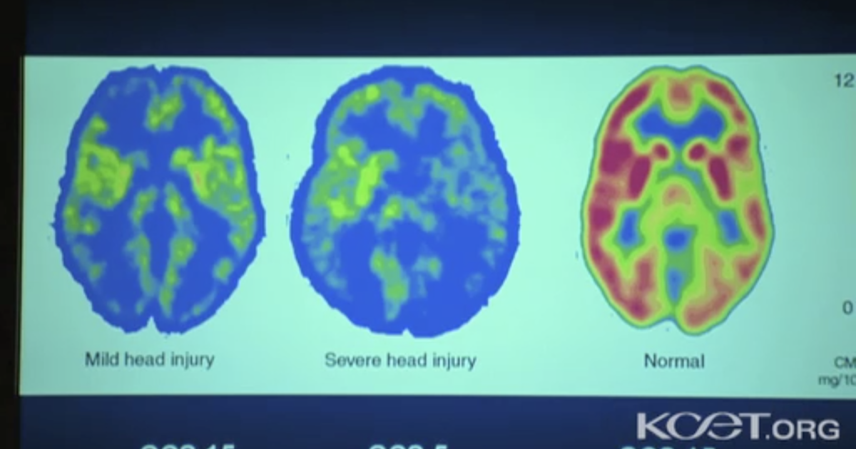 Watch Knocking Heads | SoCal Connected | PBS SoCal